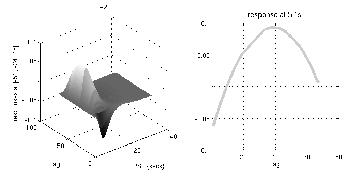 GitHub - FarkadAdnan/Statistical-Parametric-Mapping: The FIL Methods Group