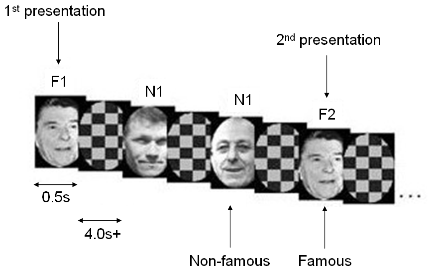 GitHub - FarkadAdnan/Statistical-Parametric-Mapping: The FIL Methods Group
