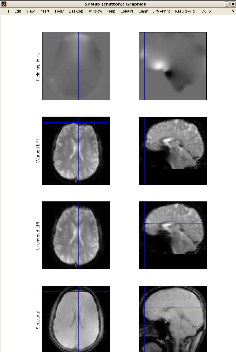 Github Farkadadnan Statistical Parametric Mapping The Fil Methods Group