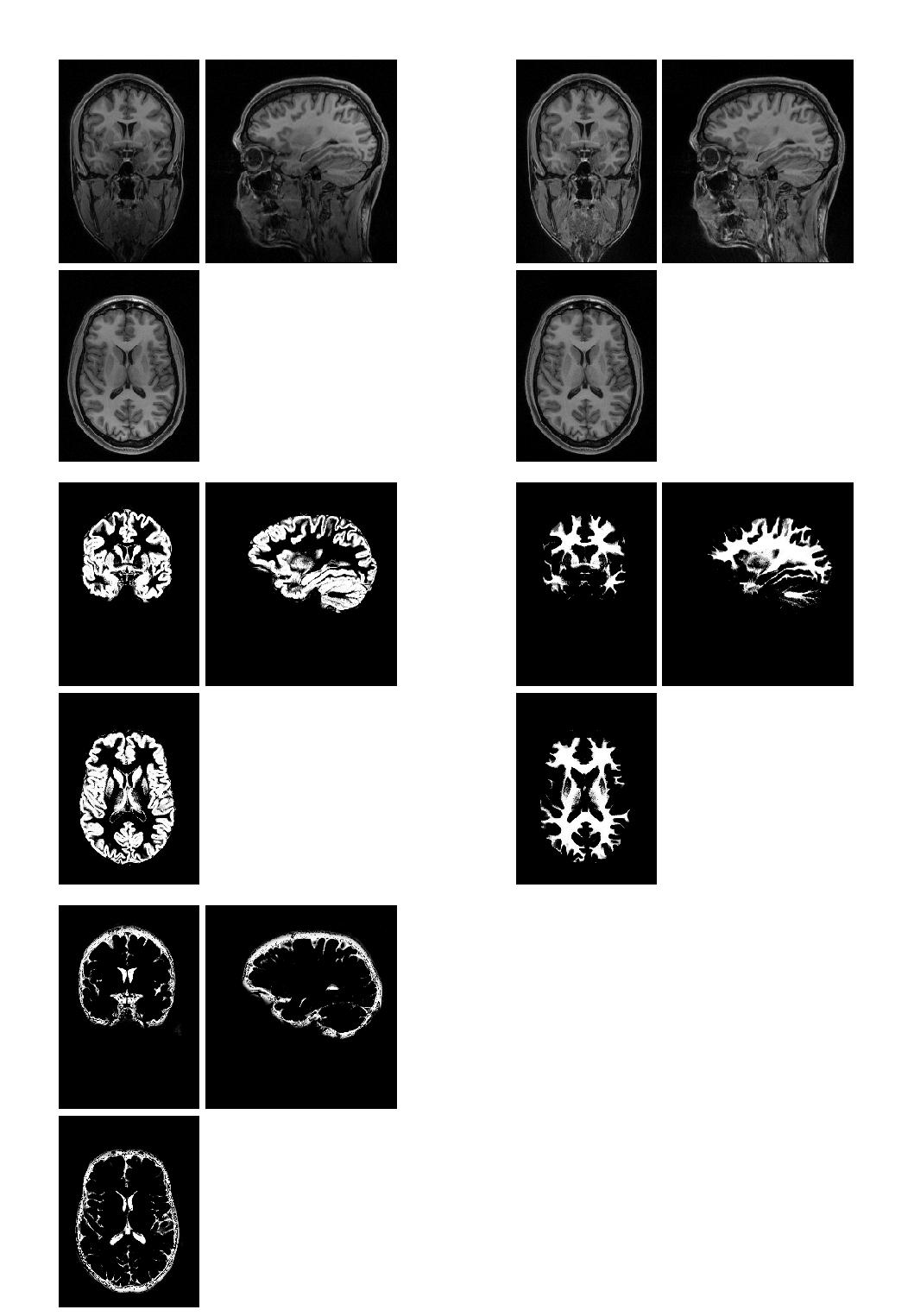 GitHub - FarkadAdnan/Statistical-Parametric-Mapping: The FIL Methods Group