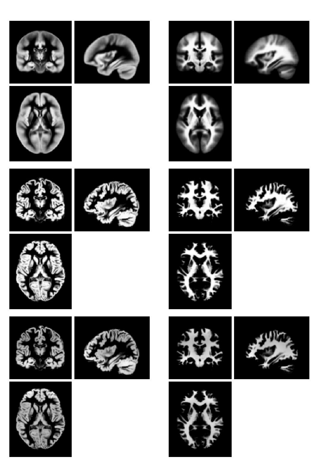 GitHub - FarkadAdnan/Statistical-Parametric-Mapping: The FIL Methods Group