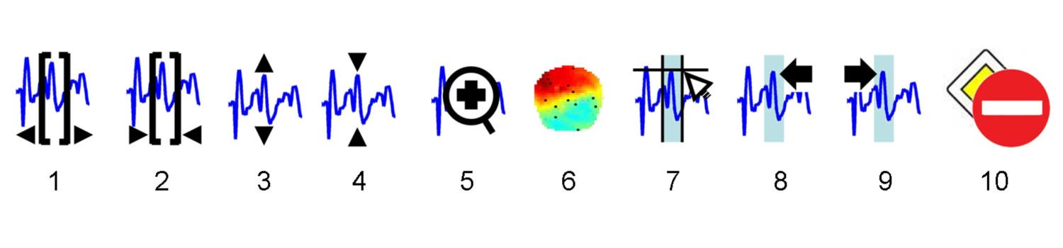 GitHub - FarkadAdnan/Statistical-Parametric-Mapping: The FIL Methods Group