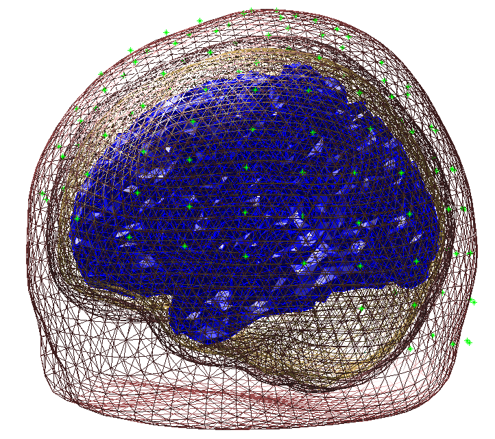 GitHub - FarkadAdnan/Statistical-Parametric-Mapping: The FIL Methods Group