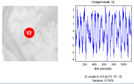 GitHub - FarkadAdnan/Statistical-Parametric-Mapping: The FIL Methods Group