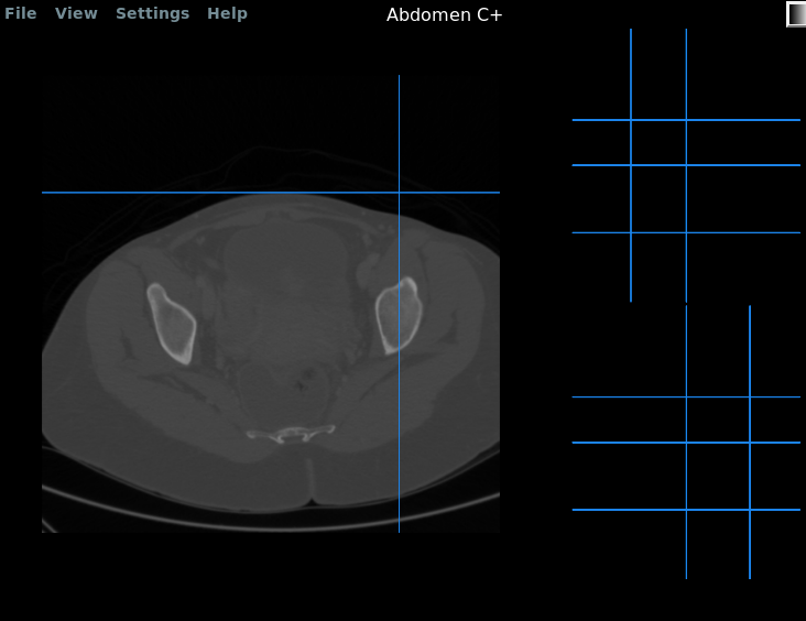 Removing The Two Right Viewers From The Orthogonal Viewer · Issue 127 · Rii Mangopapaya · Github