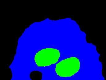 RuntimeError: 1only batches of spatial targets supported (non-empty 3D tensors) but got targets ...