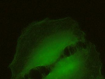 RuntimeError: 1only batches of spatial targets supported (non-empty 3D tensors) but got targets ...