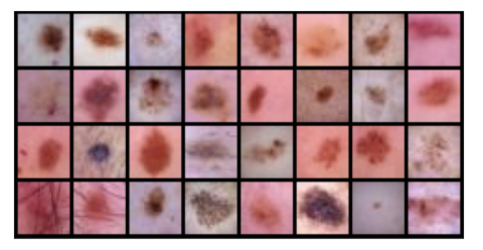 GitHub - liangkunn/Generative-Models-in-Medical-Images: A repository ...