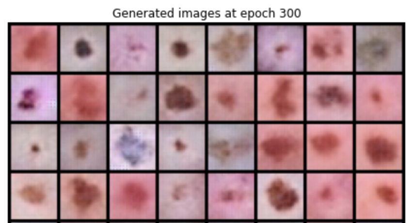 GitHub - liangkunn/Generative-Models-in-Medical-Images: A repository ...