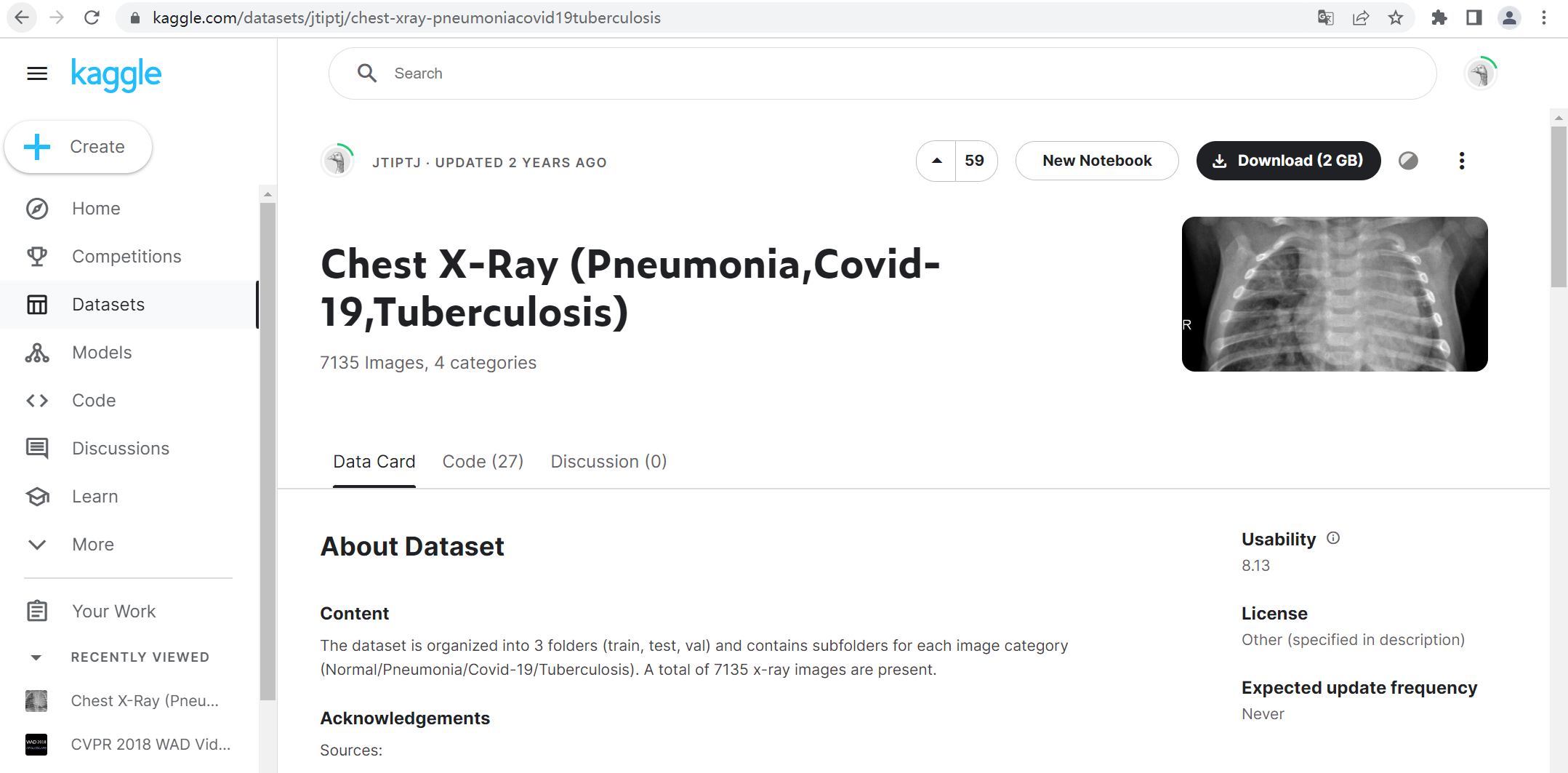 GitHub - tgltt/ChestXRayVit: Classify chest X ray pictures into 4 class(Normal/Pneumonia/Covid ...