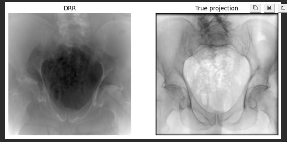DRR intensity inconsistency. · Issue #130 · eigenvivek/DiffDRR · GitHub
