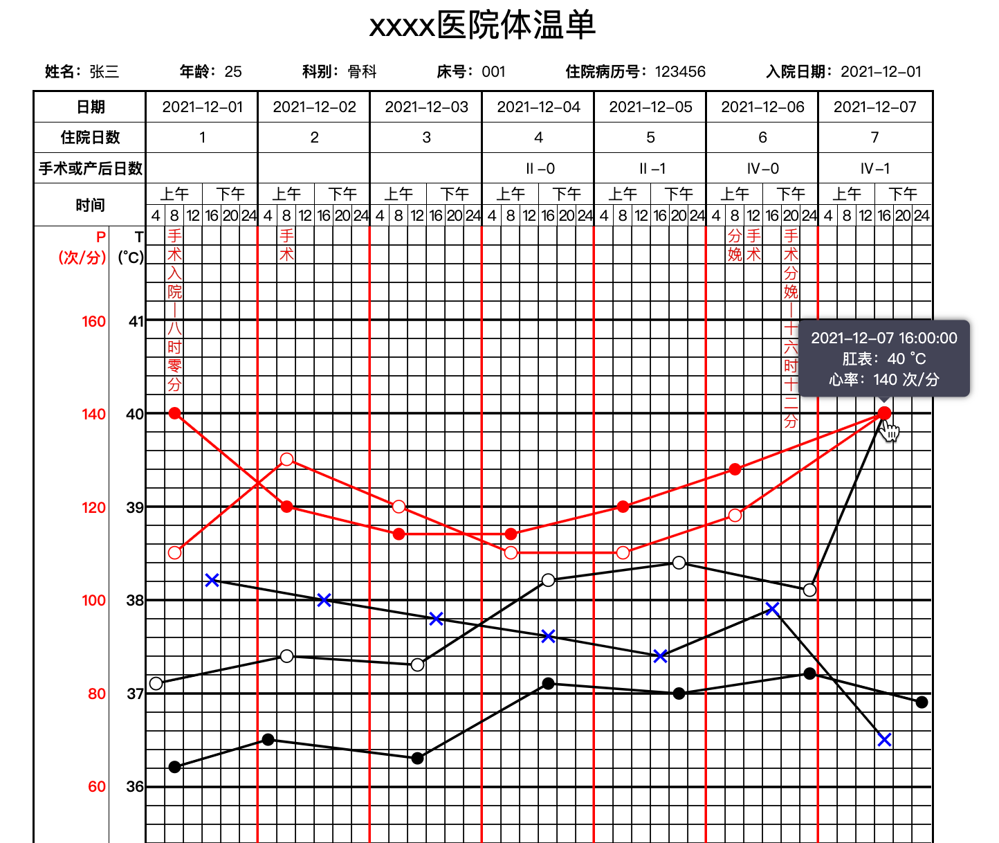 hover重合点的边缘时，展示信息缺失。 · Issue #2 · centuryeggs/temperature-chart · GitHub