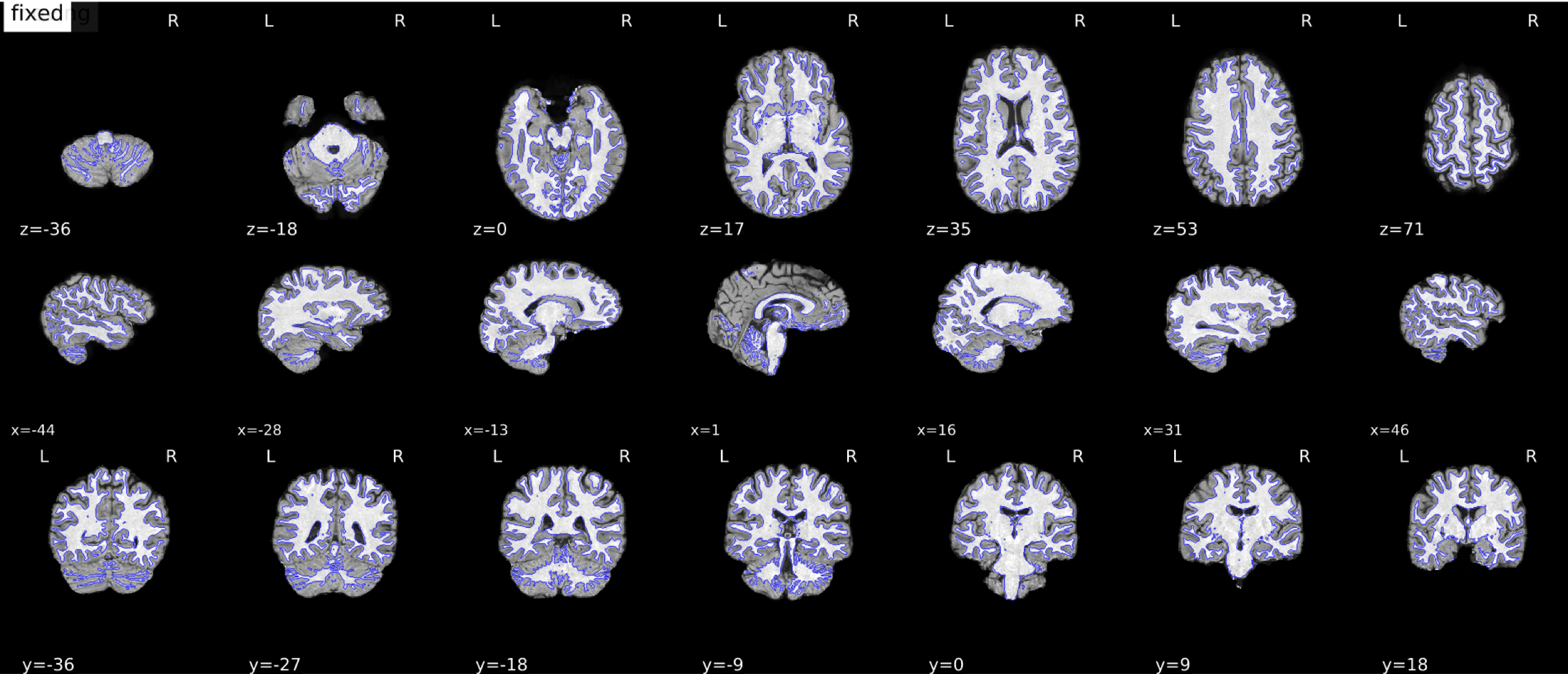 Alignment problem · Issue #2362 · nipreps/fmriprep · GitHub