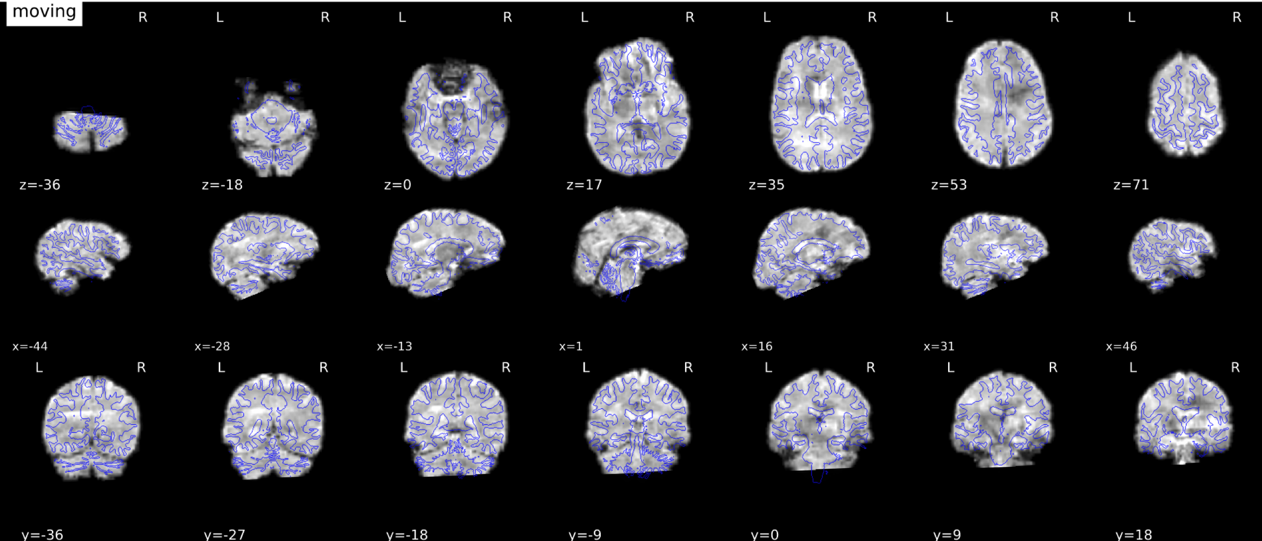 Alignment problem · Issue #2362 · nipreps/fmriprep · GitHub