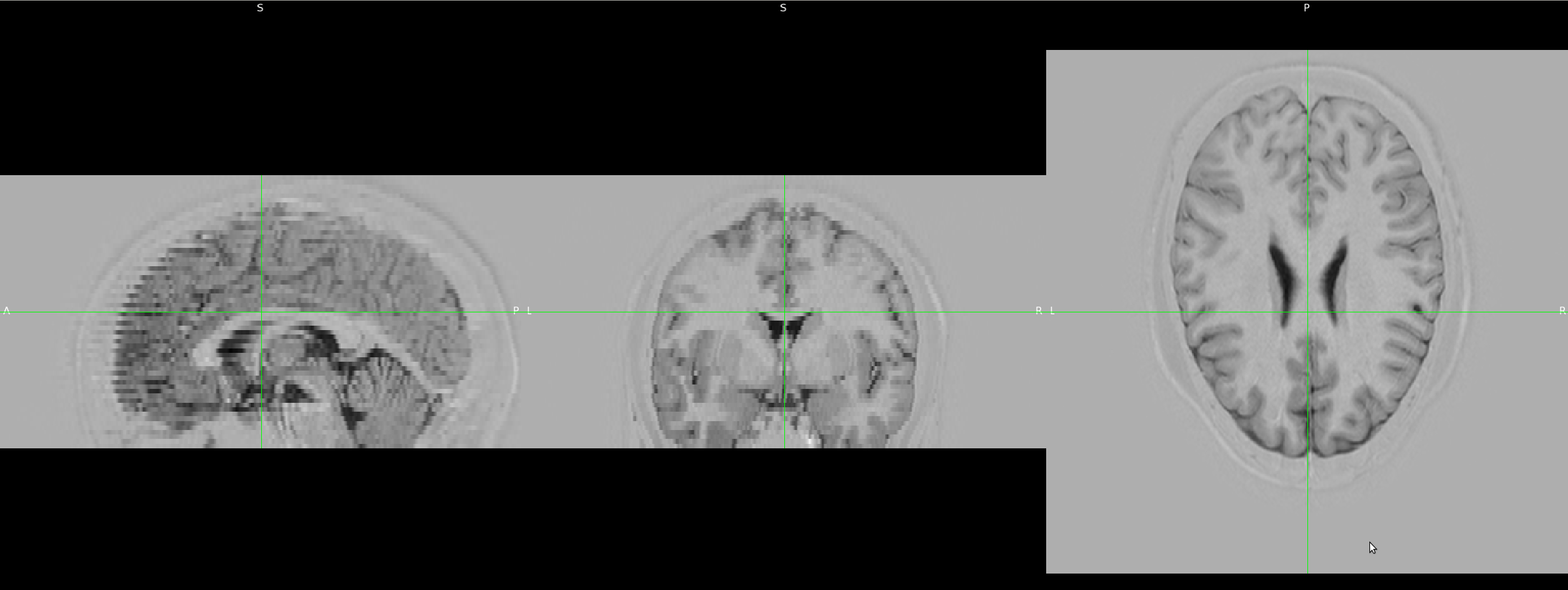 Using Inversion Recovery Image When T1w Is Not Available · Issue 2952 · Niprepsfmriprep · Github