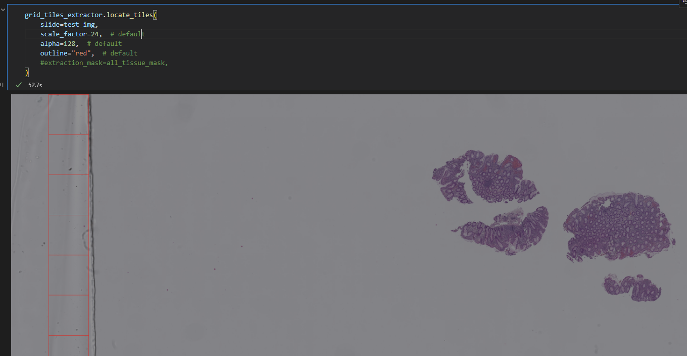 GridTiler() does not locate tiles correctly (artifacts-non tissue) · Issue #513 · histolab ...