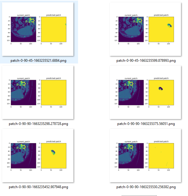 Empty Segmentation While Patch Predictions Non Empty · Issue 1165