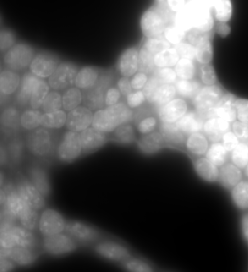 General pre-processing before 3-D segmentation · Issue #136 · MouseLand/cellpose · GitHub