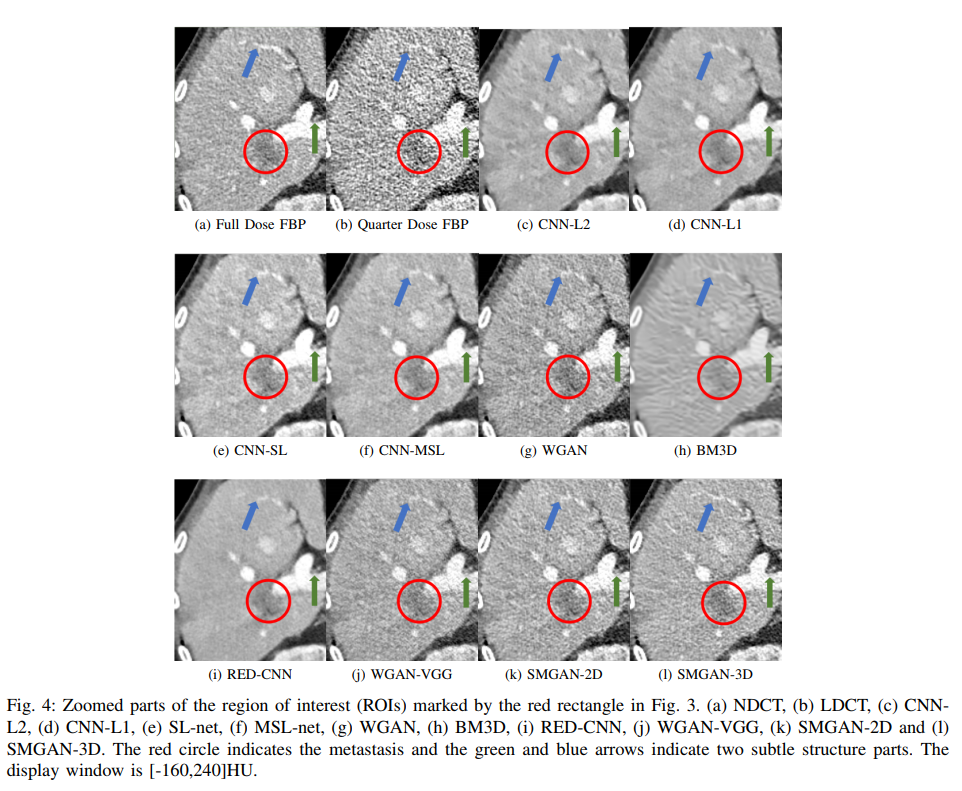 Github Growingfuturestructure Sensitive Multi Scale Deep Neural Network For Low Dose Ct Denoising 