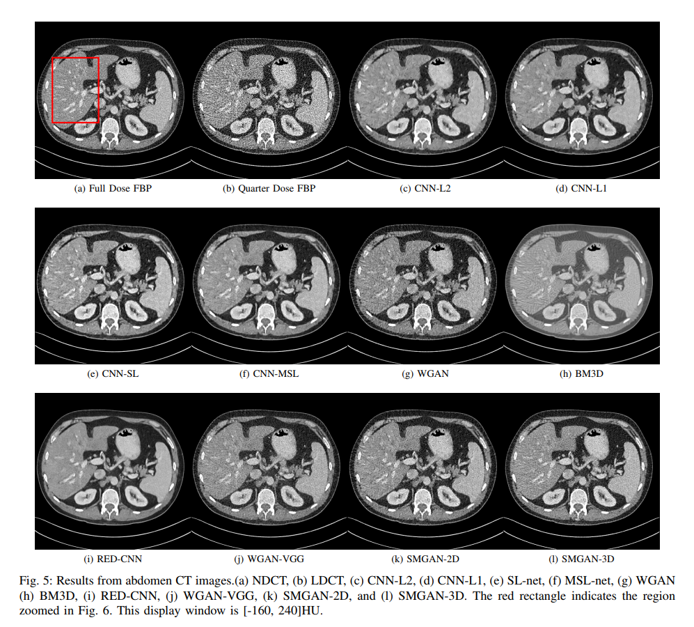 GitHub - growingfuture/Structure-sensitive-Multi-scale-Deep-Neural-Network-for-Low-Dose-CT-Denoising