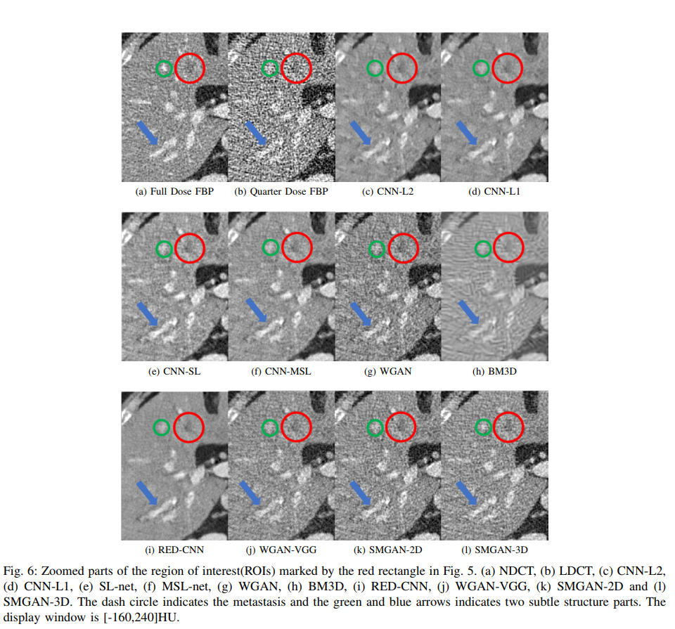 Github Growingfuturestructure Sensitive Multi Scale Deep Neural Network For Low Dose Ct Denoising 9218