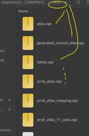 train.py: error: the following arguments are required: --img-list · Issue #355 · voxelmorph ...