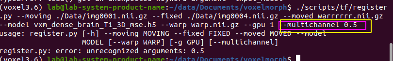 Error while trying to register with Voxelmorph · Issue #378 · voxelmorph/voxelmorph · GitHub