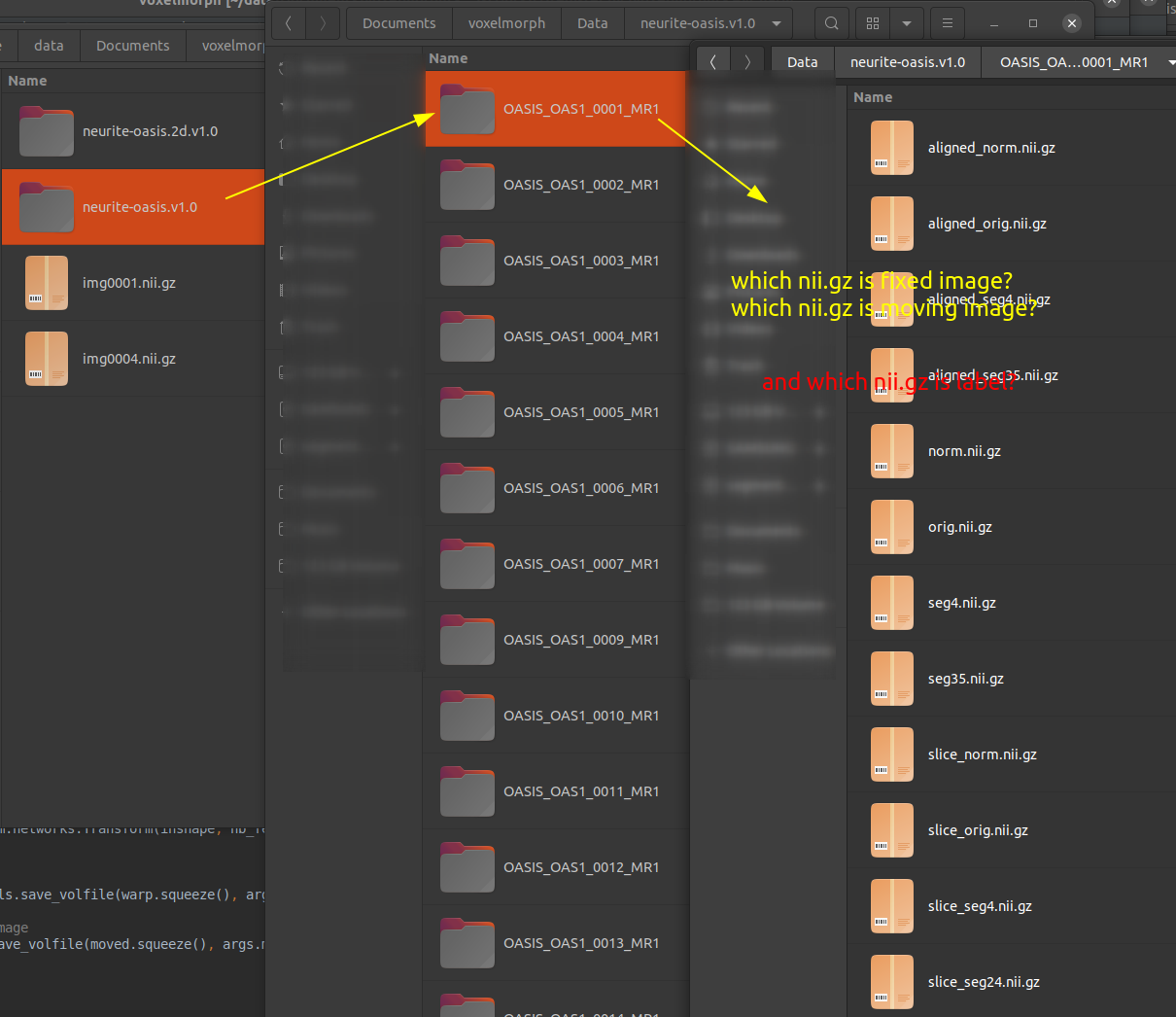 Error while trying to register with Voxelmorph · Issue #378 · voxelmorph/voxelmorph · GitHub