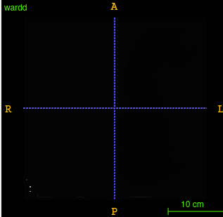 Error while trying to register with Voxelmorph · Issue #378 · voxelmorph/voxelmorph · GitHub