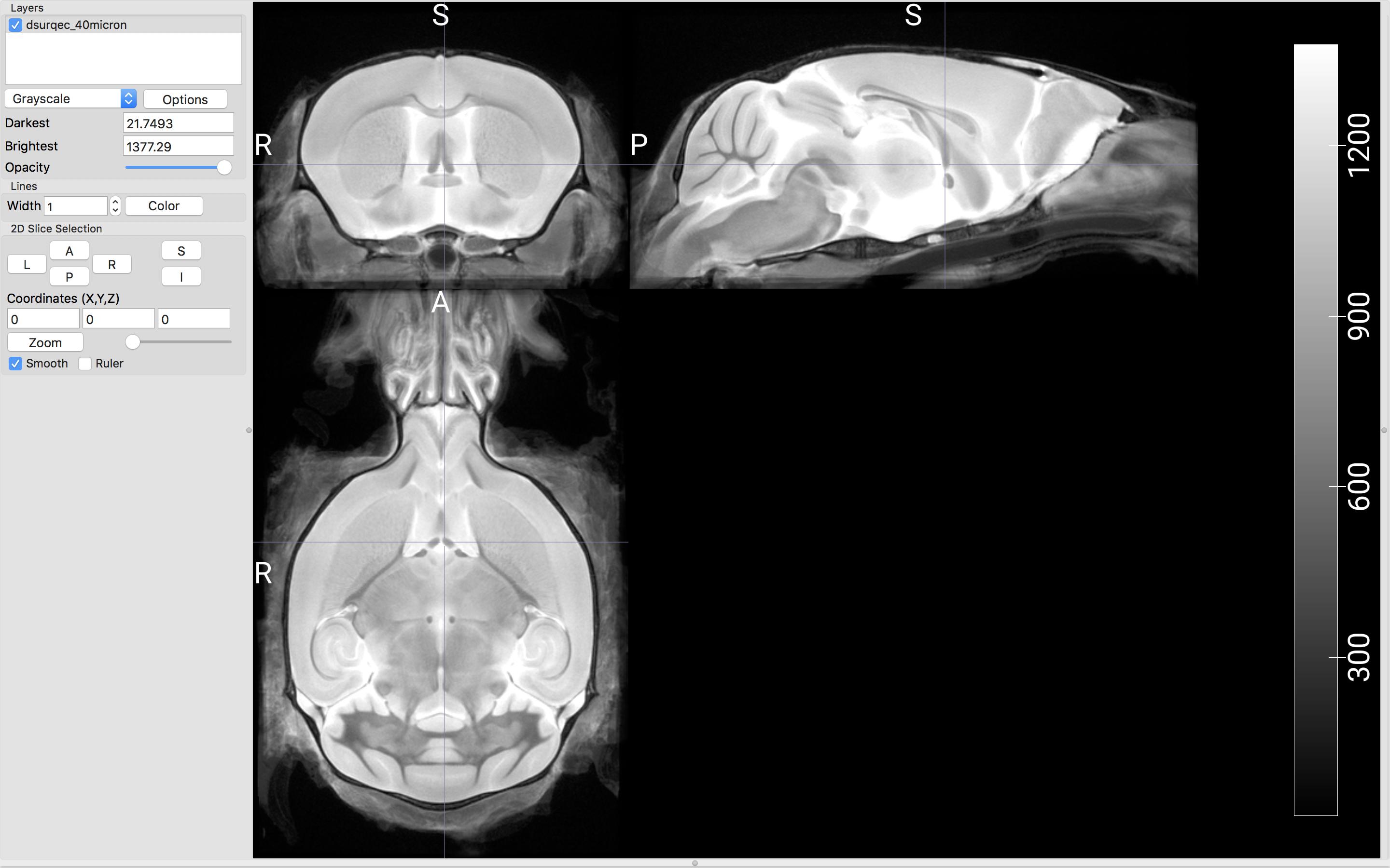 Display Issues in FSLeyes · Issue #56 · pauldmccarthy/fsleyes · GitHub