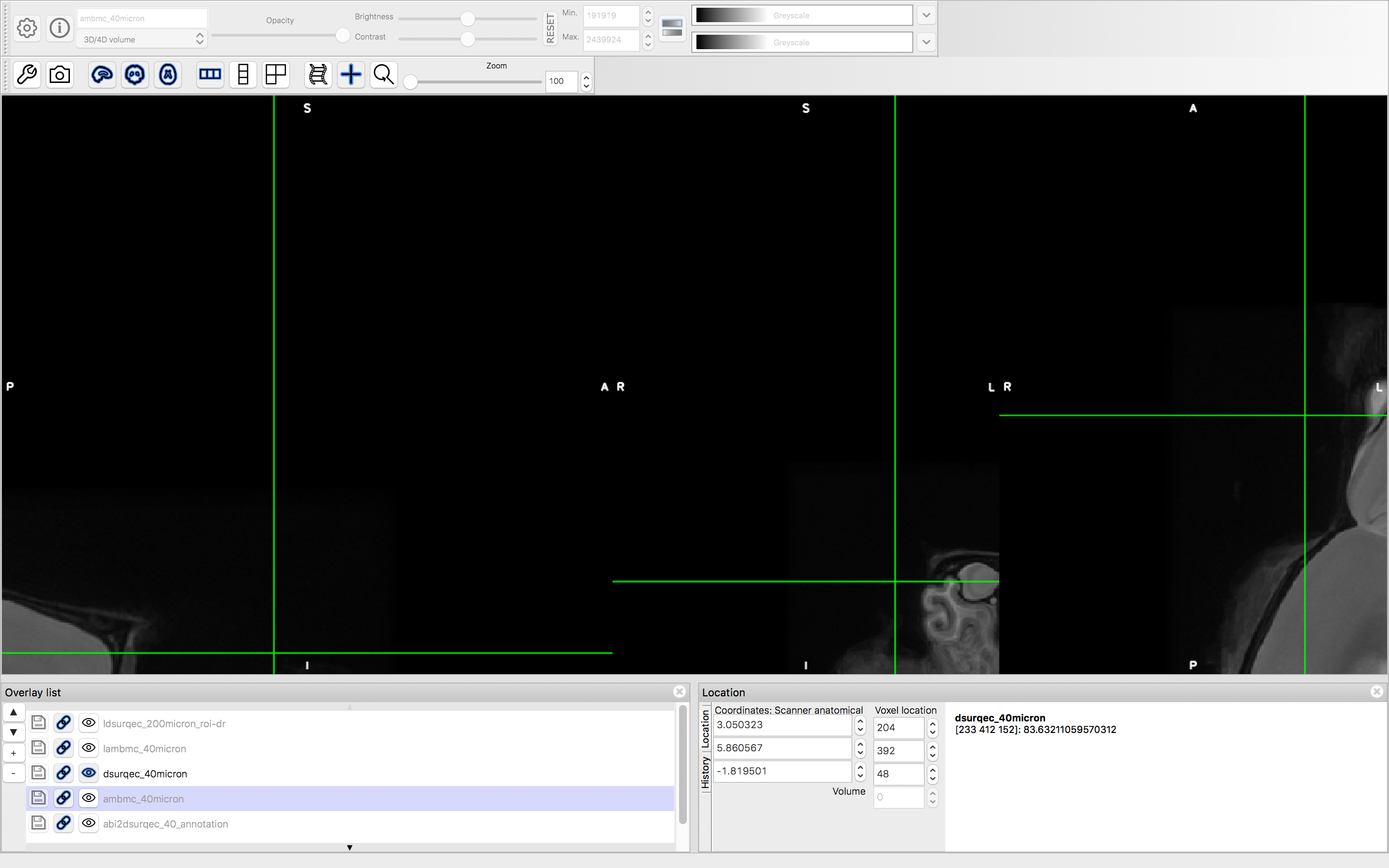 Display Issues in FSLeyes · Issue #56 · pauldmccarthy/fsleyes · GitHub