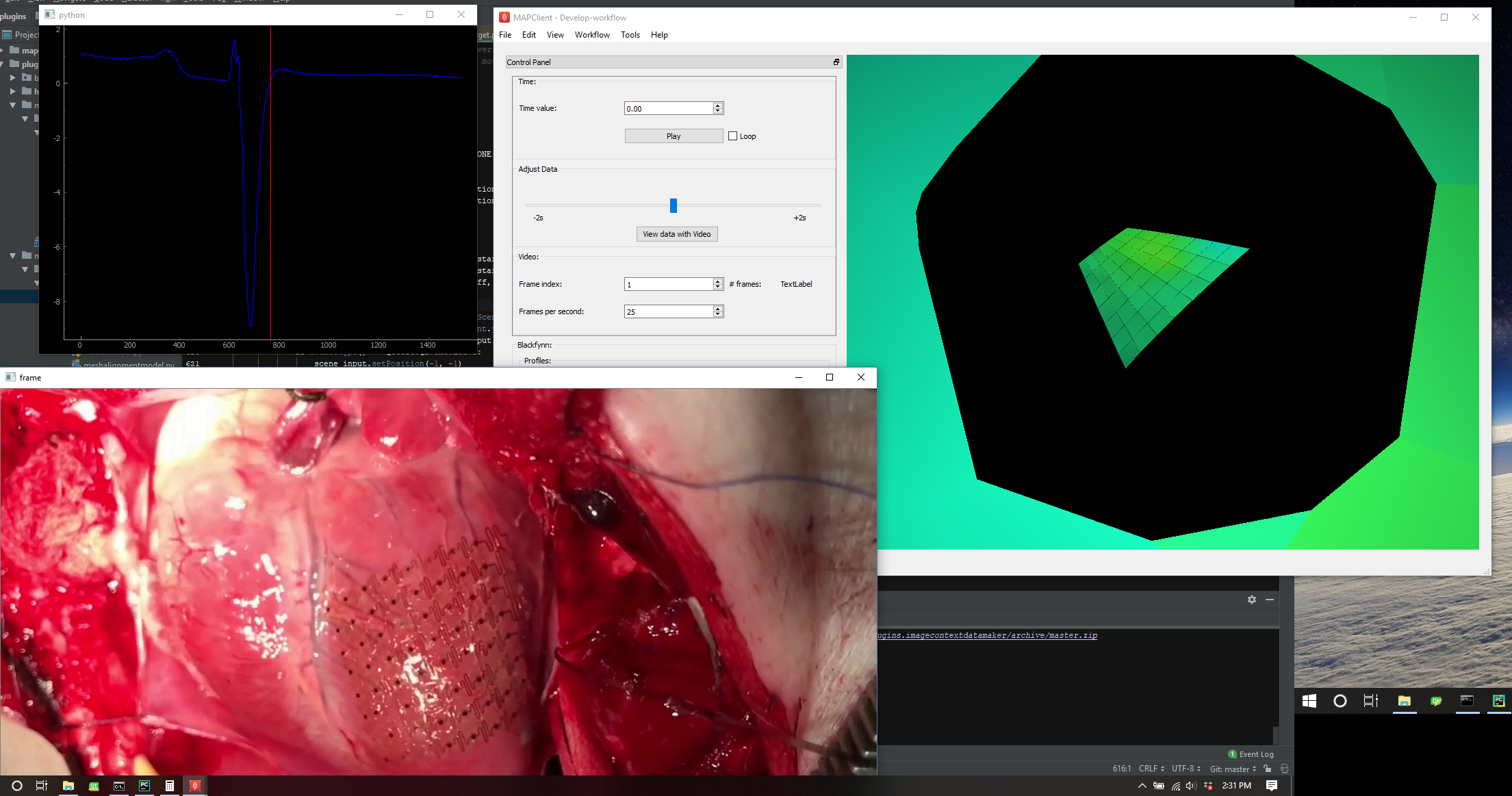 GitHub - Tehsurfer/mapclientplugins.ecgstep: A Mapclient plugin for loading ecg data onto a 3D ...