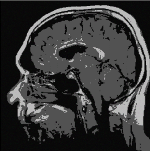 GitHub - sohailamahmoud/Computer_Vision_Tasks