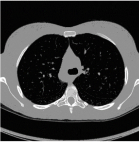 GitHub - sohailamahmoud/Computer_Vision_Tasks