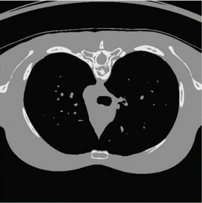 GitHub - sohailamahmoud/Computer_Vision_Tasks