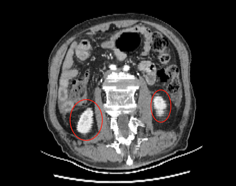 When ImageReslice can support InterpolationMode.CUBIC ? · Issue #1083 ...