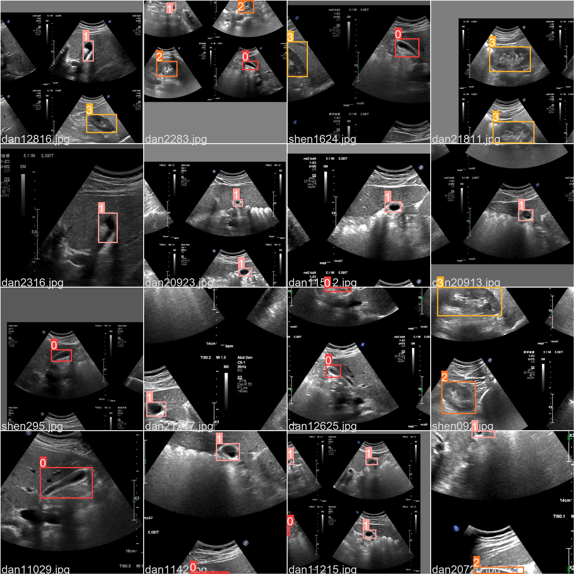 GitHub - Sun-WeiZhen/Organ-detection-algorithm-based-on-YOLOv5s