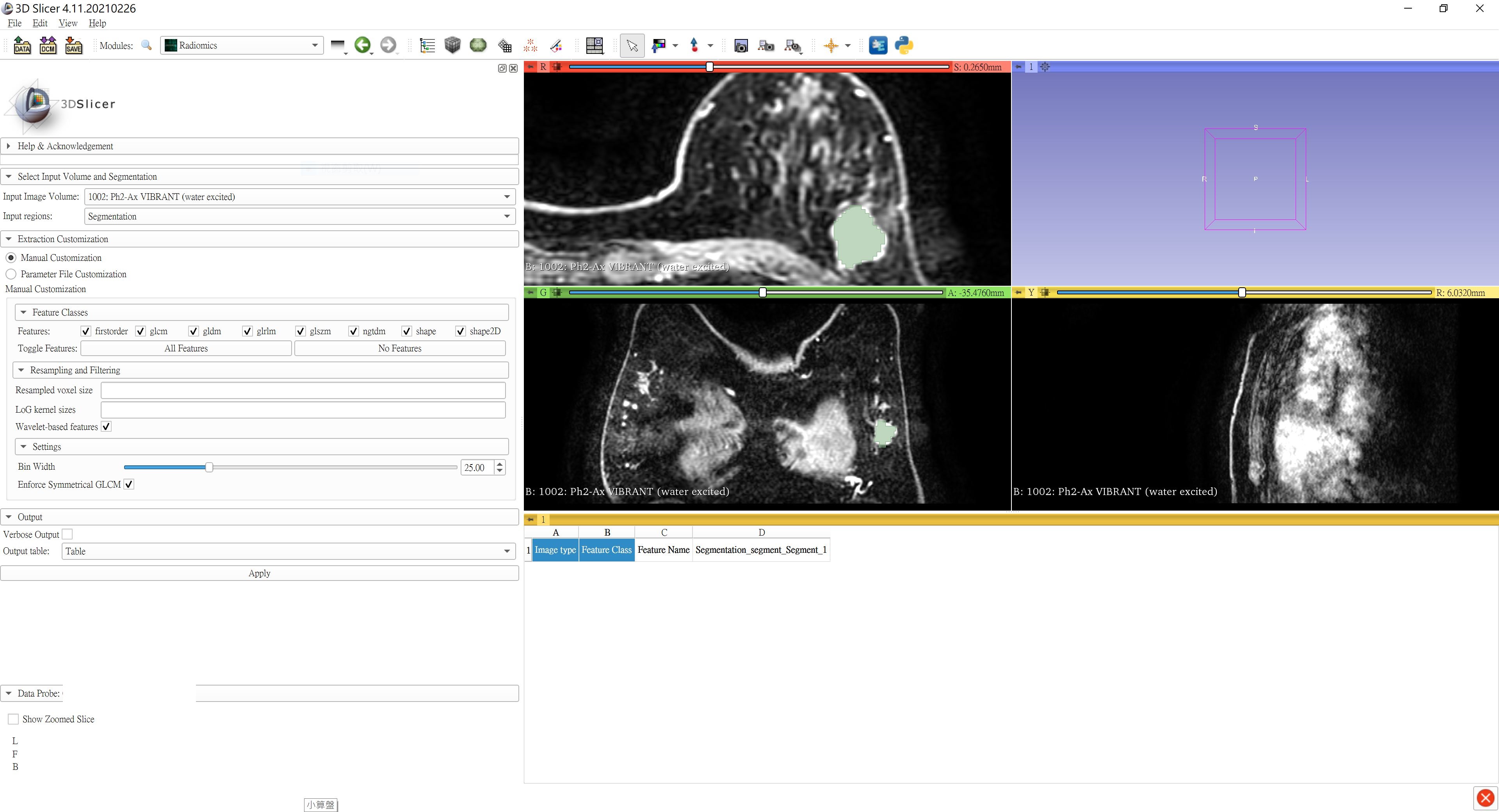 [BUG] Enabling wavelet calculation may have empty result in 3D Slicer · Issue #712 · AIM-Harvard ...