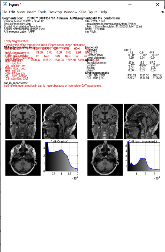 Error with headreco in some cases · Issue #10 · simnibs/simnibs · GitHub