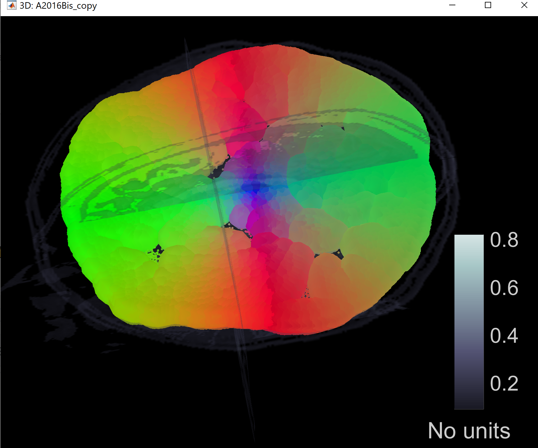 MRI display/overlay and registration with DWI (4D images) · Issue #267 · brainstorm-tools ...