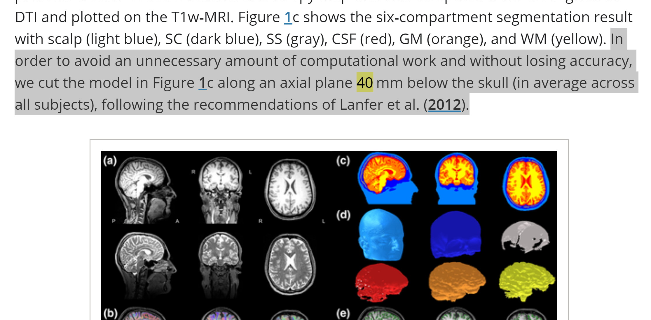 FEM: Remove bottom part of head model · Issue #293 · brainstorm-tools/brainstorm3 · GitHub