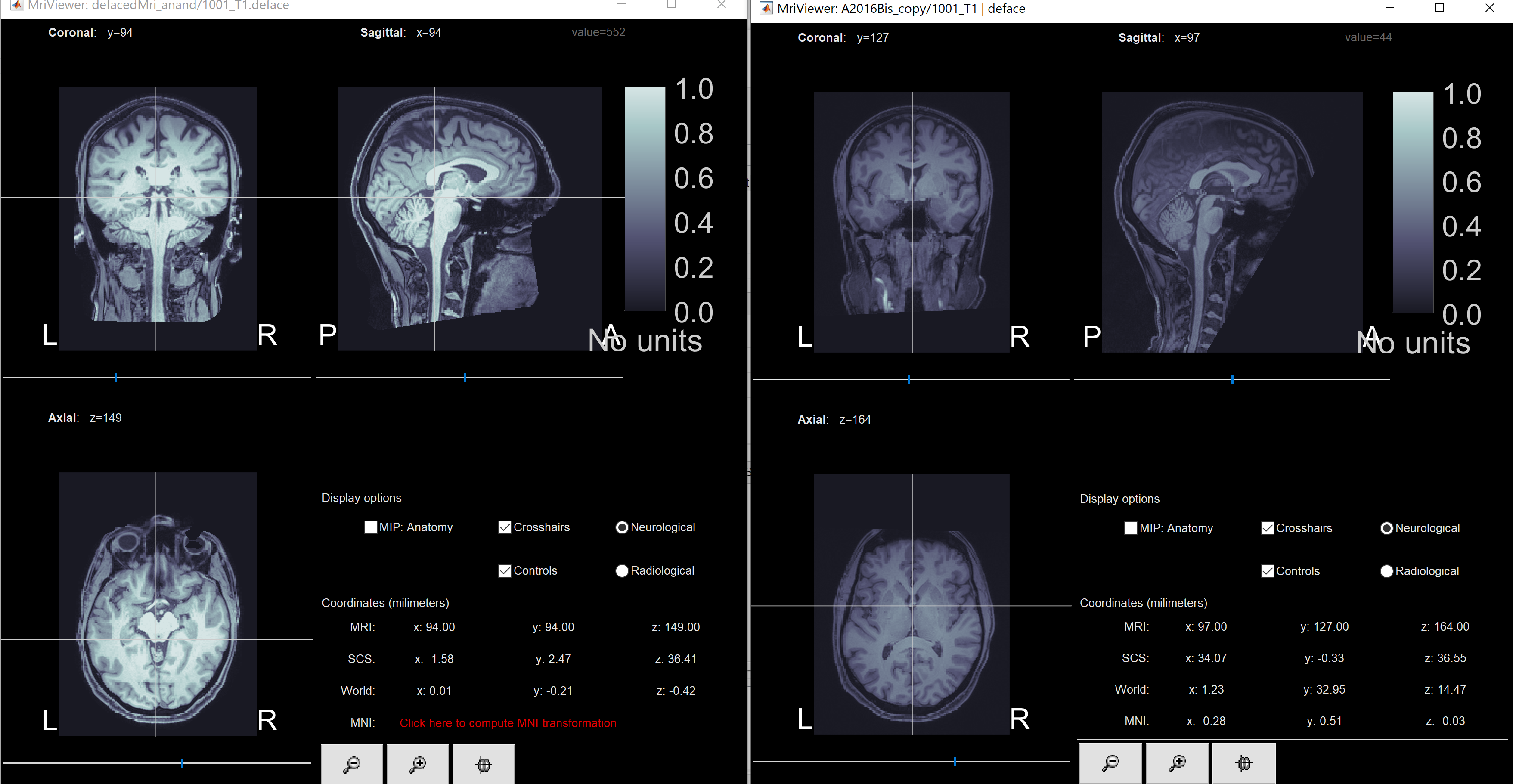 new method for defacing MRI (3D and 4D volume) · Issue #307 ...