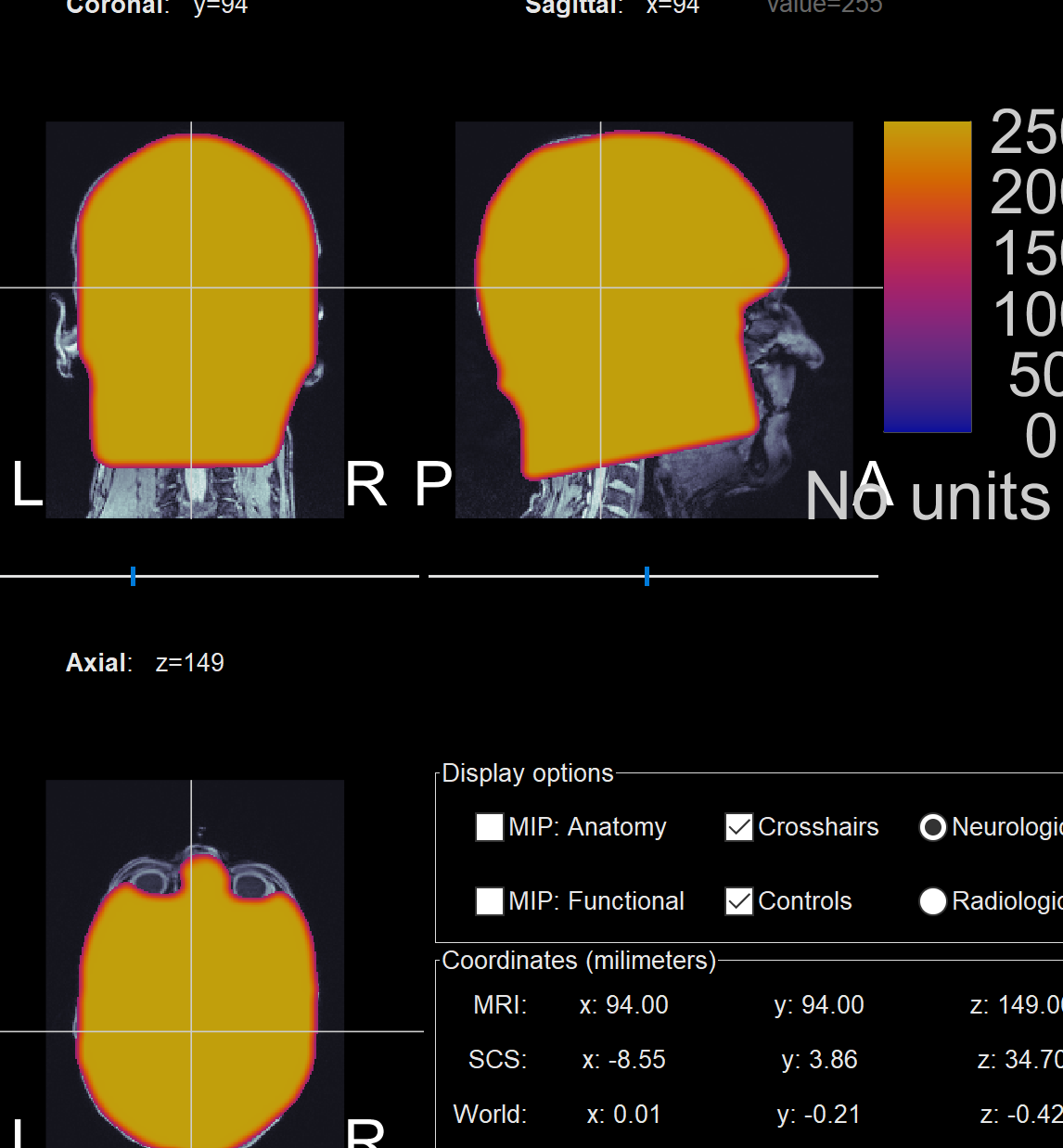 new method for defacing MRI (3D and 4D volume) · Issue #307 ...