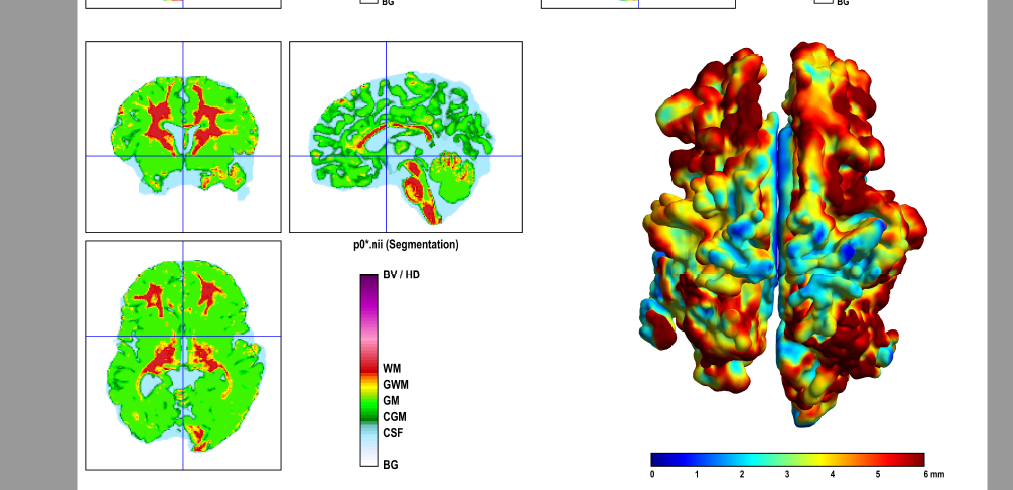 Headreco with an infant MRI · Issue #36 · simnibs/simnibs · GitHub