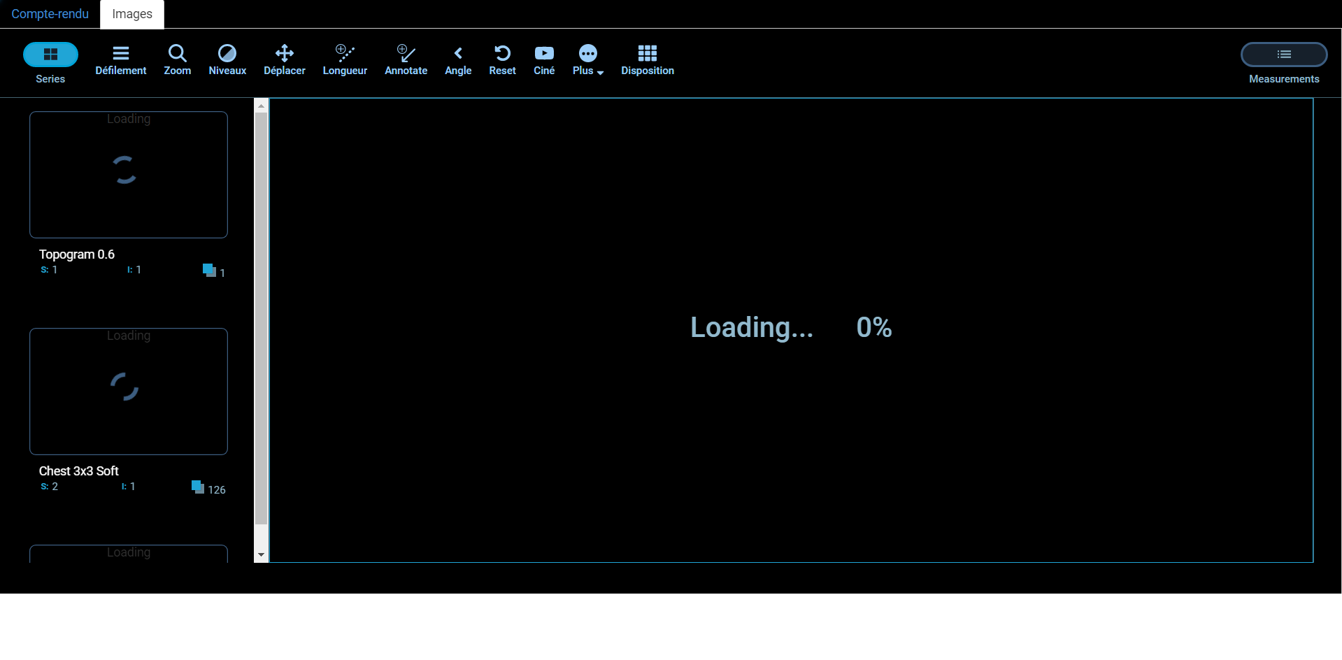 Loading study : the "loading" display is always displaying 0% before showing the study image ...