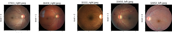 GitHub - Aishuvenkat09/Diabetic-Retinopathy-Detection