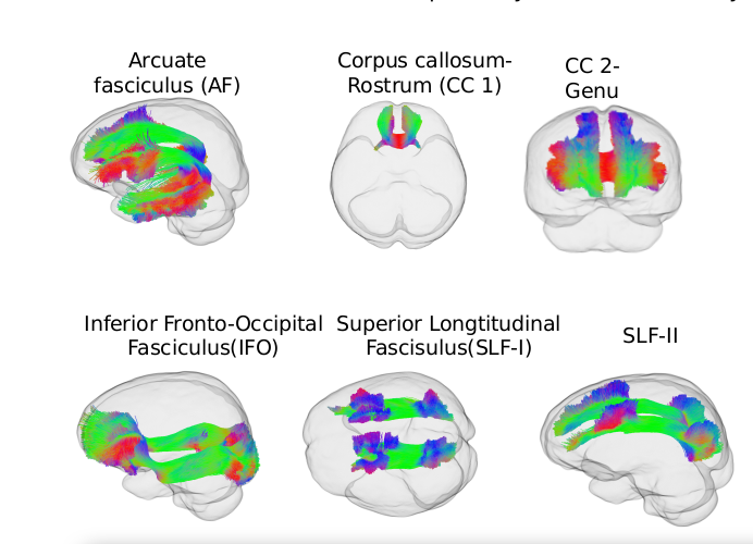 Questions about alignment to MNI image · Issue #167 · MIC-DKFZ/TractSeg ...