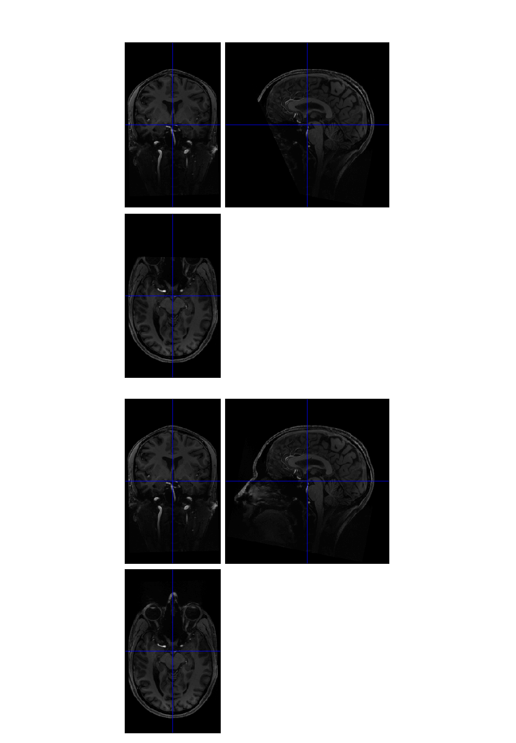 [ENH] Create workflow to deface all the anat files in a dataset. · Issue #176 · cpp-lln-lab ...