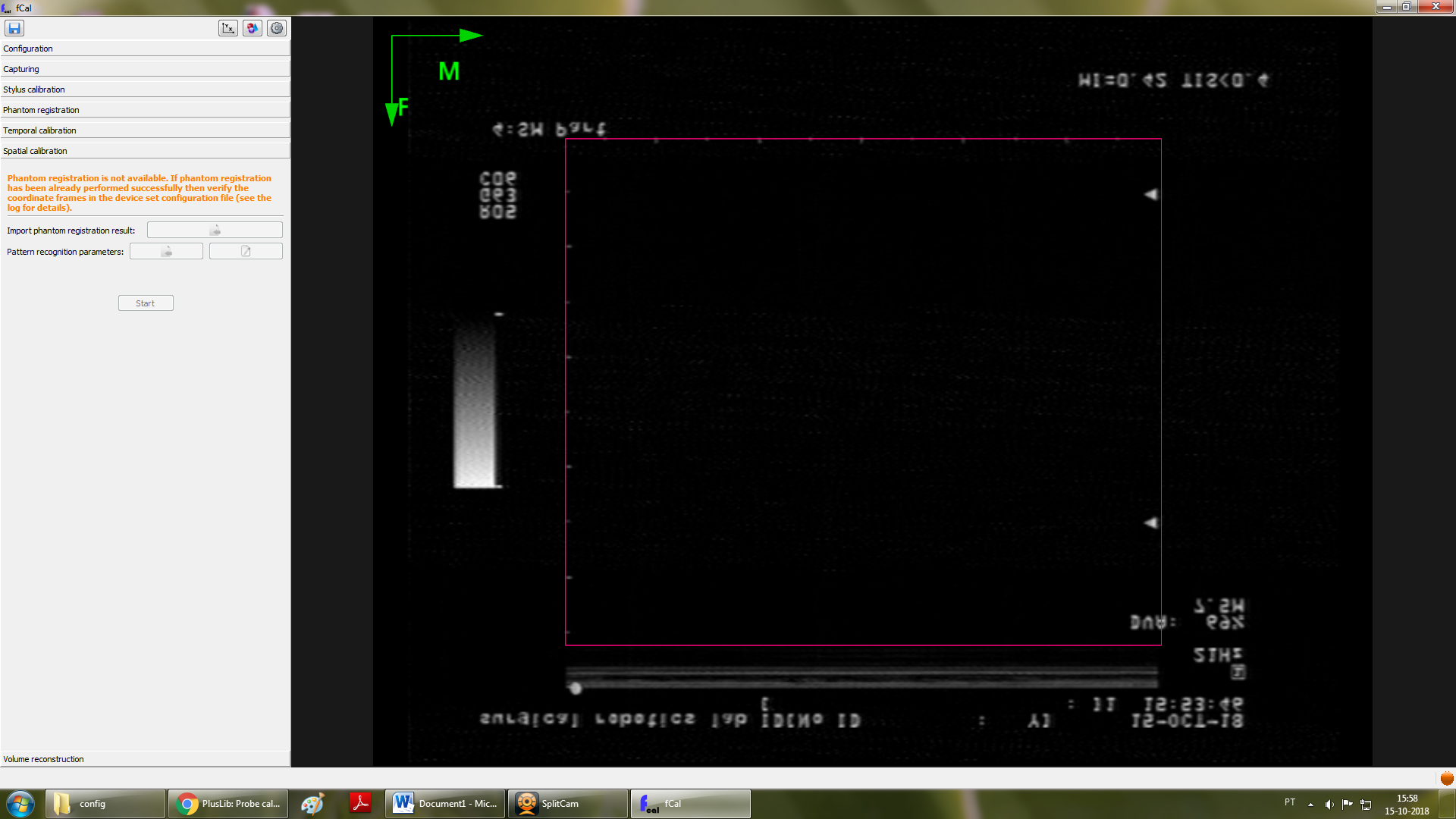 PLUS - frame grabber problem · Issue #413 · PlusToolkit/PlusLib · GitHub
