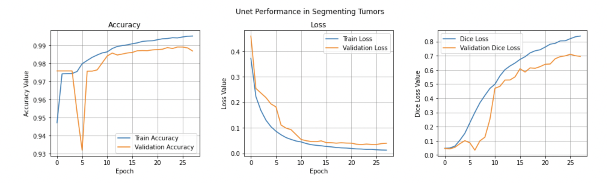 Github Yagmurtech Unet Brain Tumor Transfer Learning